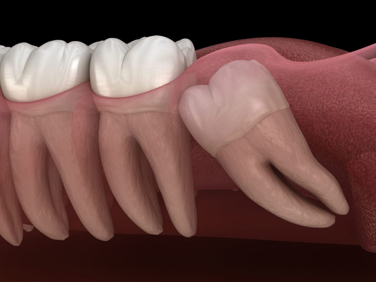 Oral Surgery - Yatton Dental
